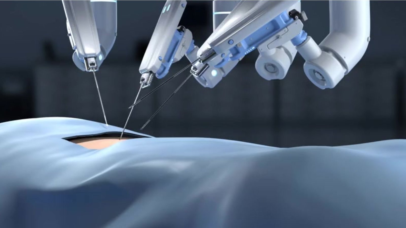 Robotic surgeries in urology, gynecology, and abdominal surgery - MMT ...